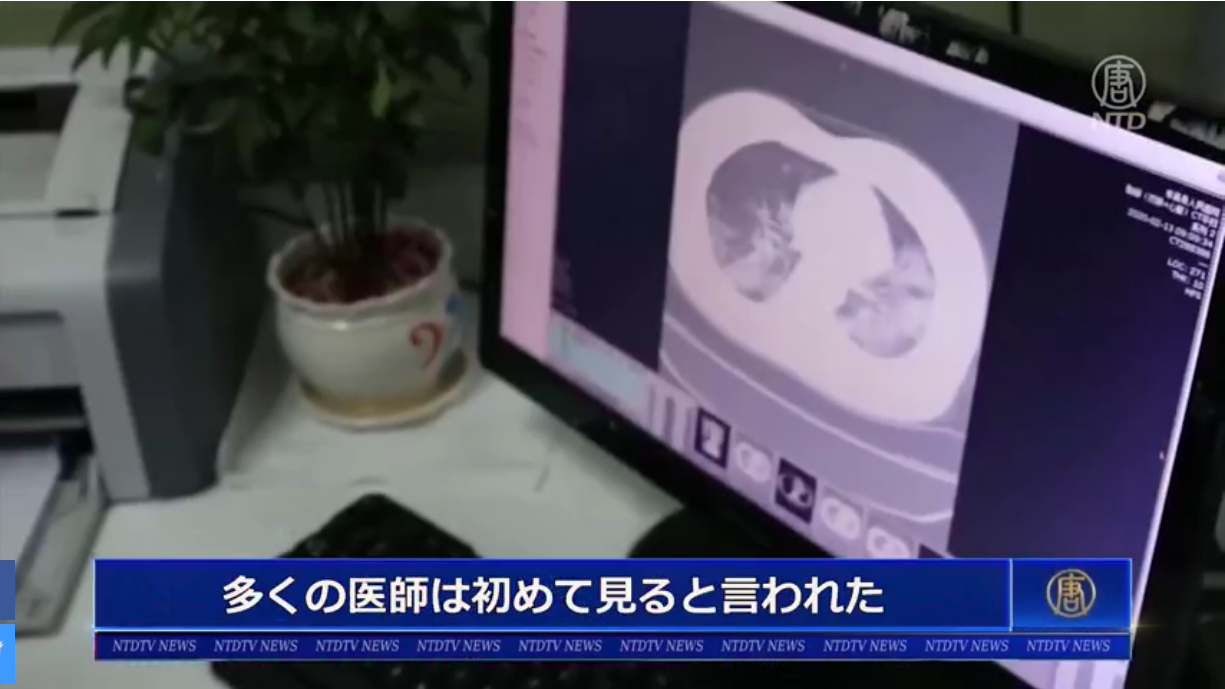 Screenshot 2022-12-26 at 14-58-24 北京の問題は深刻 市民は怒り心頭 – NTDTV Japan ｜ 保守速報